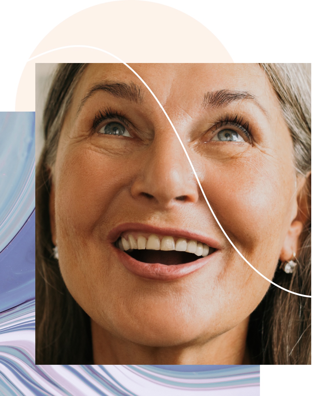 Couperose, érythrose, rosacée | soins des rougeurs | Aesthé