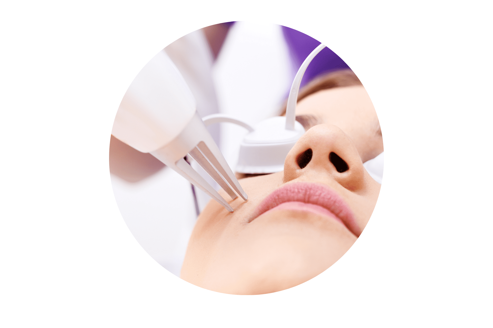 Laser en médecine esthétique : quels sont les différents types de laser ...