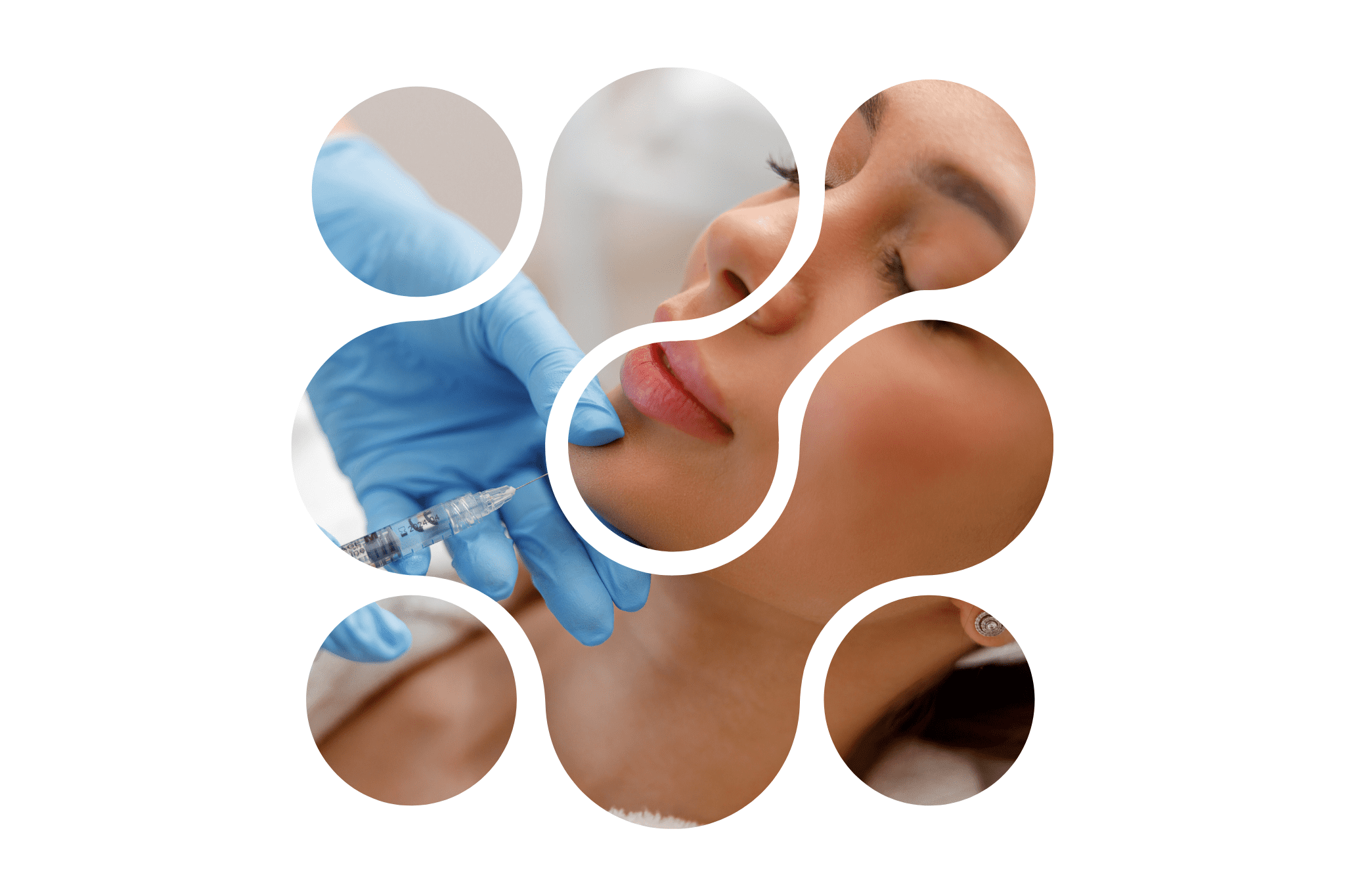 Différence entre le botox et l’acide hyaluronique : tout savoir avant ...