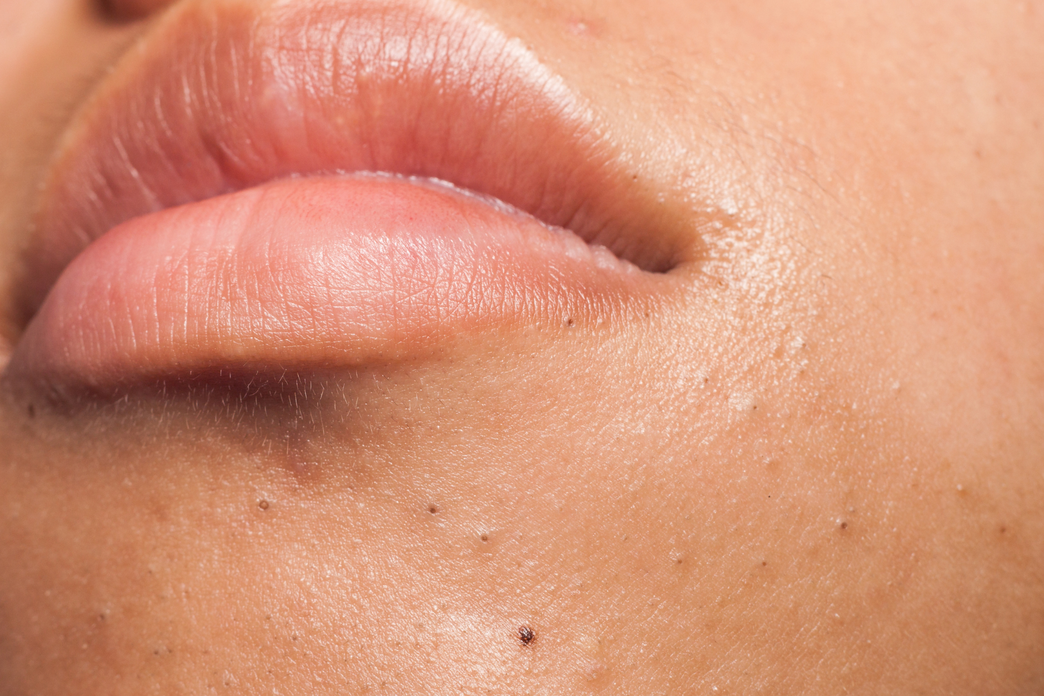 Une peau granuleuse, rugueuse, après l'exposition au soleil ? - Que faire