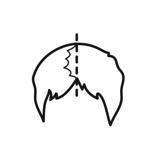 Teigne : quels sont les premiers symptômes et les traitements