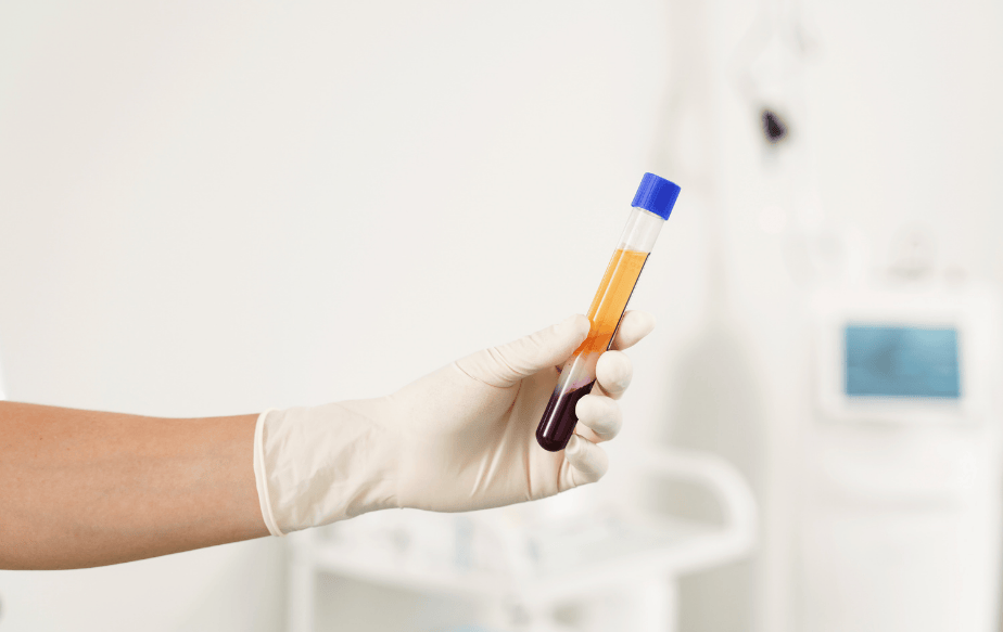 Plasma riche en plaquette : interdiction des injections PRP visage