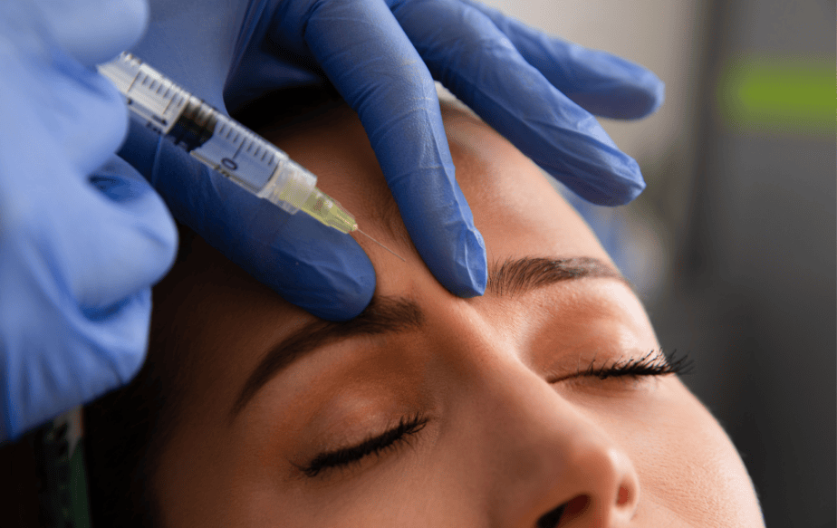 Baby Botox : La nouvelle technique pour rajeunir son visage tout en douceur
