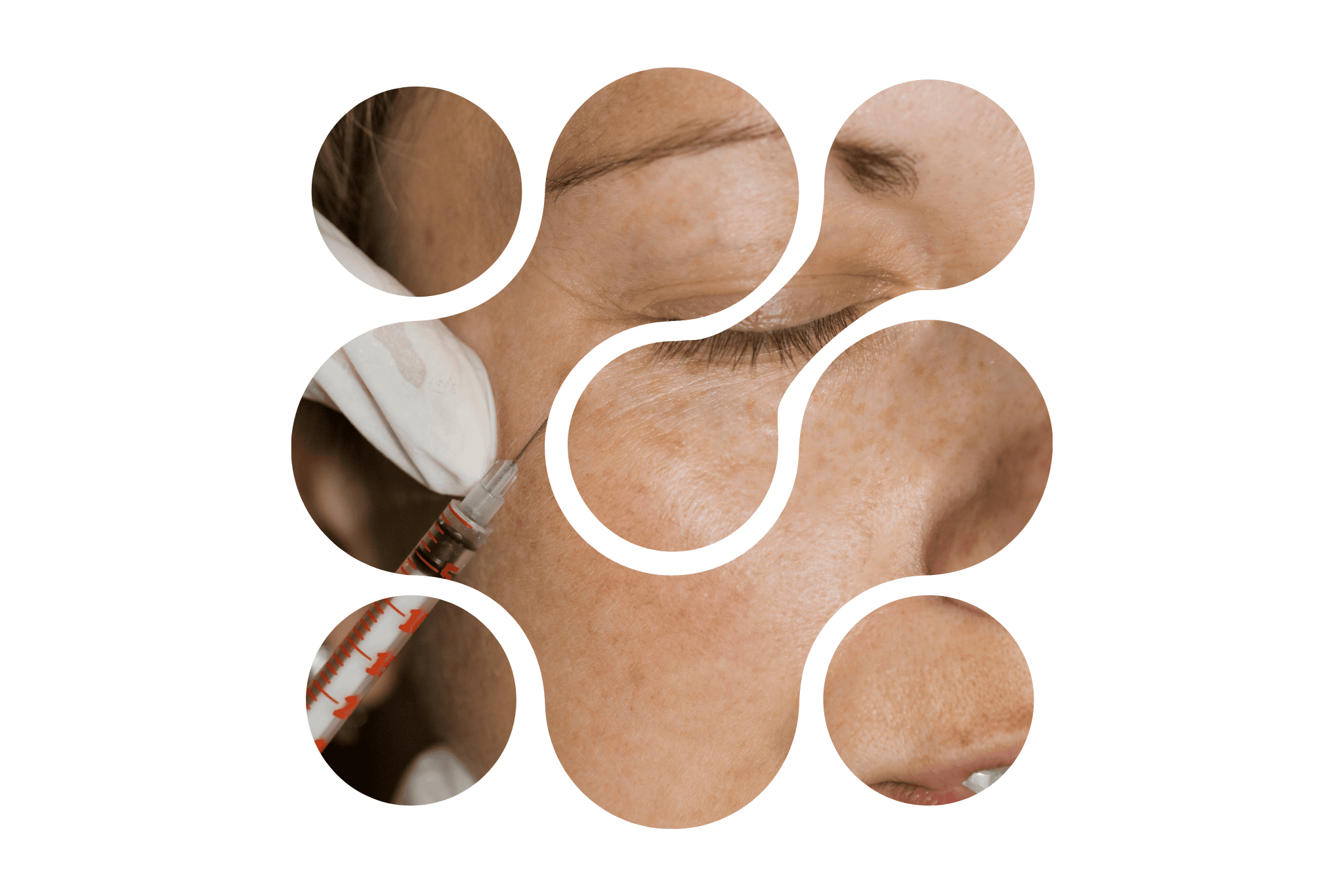 Sérum à l'argireline vs botox : Quelle solution anti-rides choisir