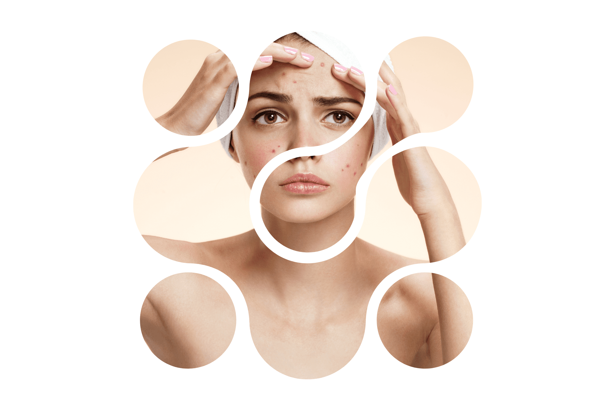 Pour une peau sans défaut : Évitez de percer vos boutons