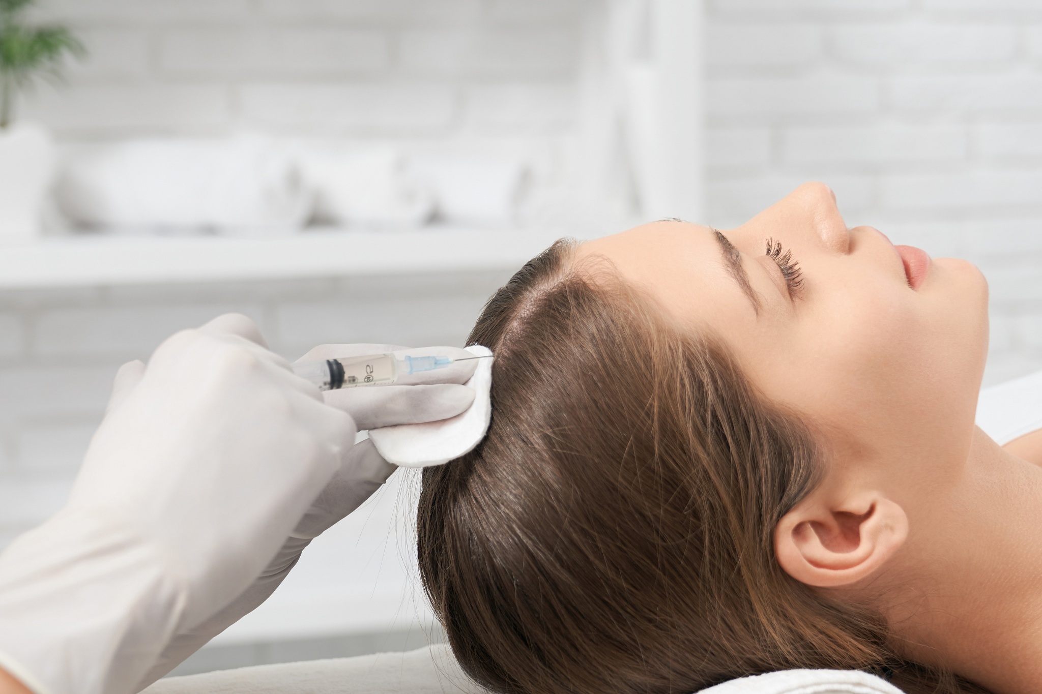 Quelle est la meilleure technique de greffe de cheveux