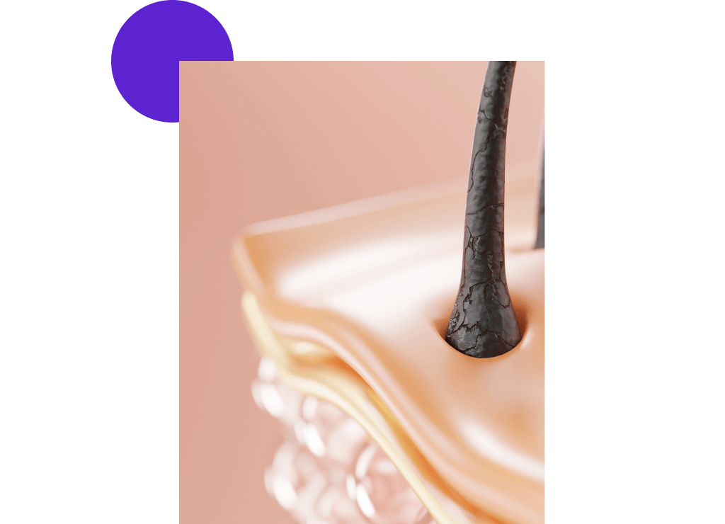 Combien de greffons ai-je besoin pour une greffe de cheveux