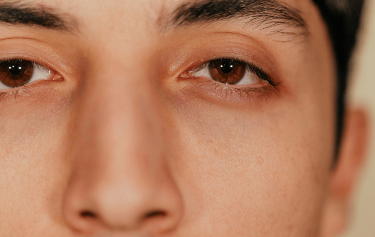 Yeux fatigués : comment lutter contre la fatigue oculaire et le regard ...