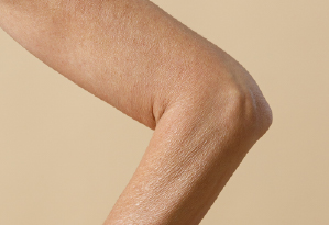 Raffermir ses bras et retendre la peau : Les techniques