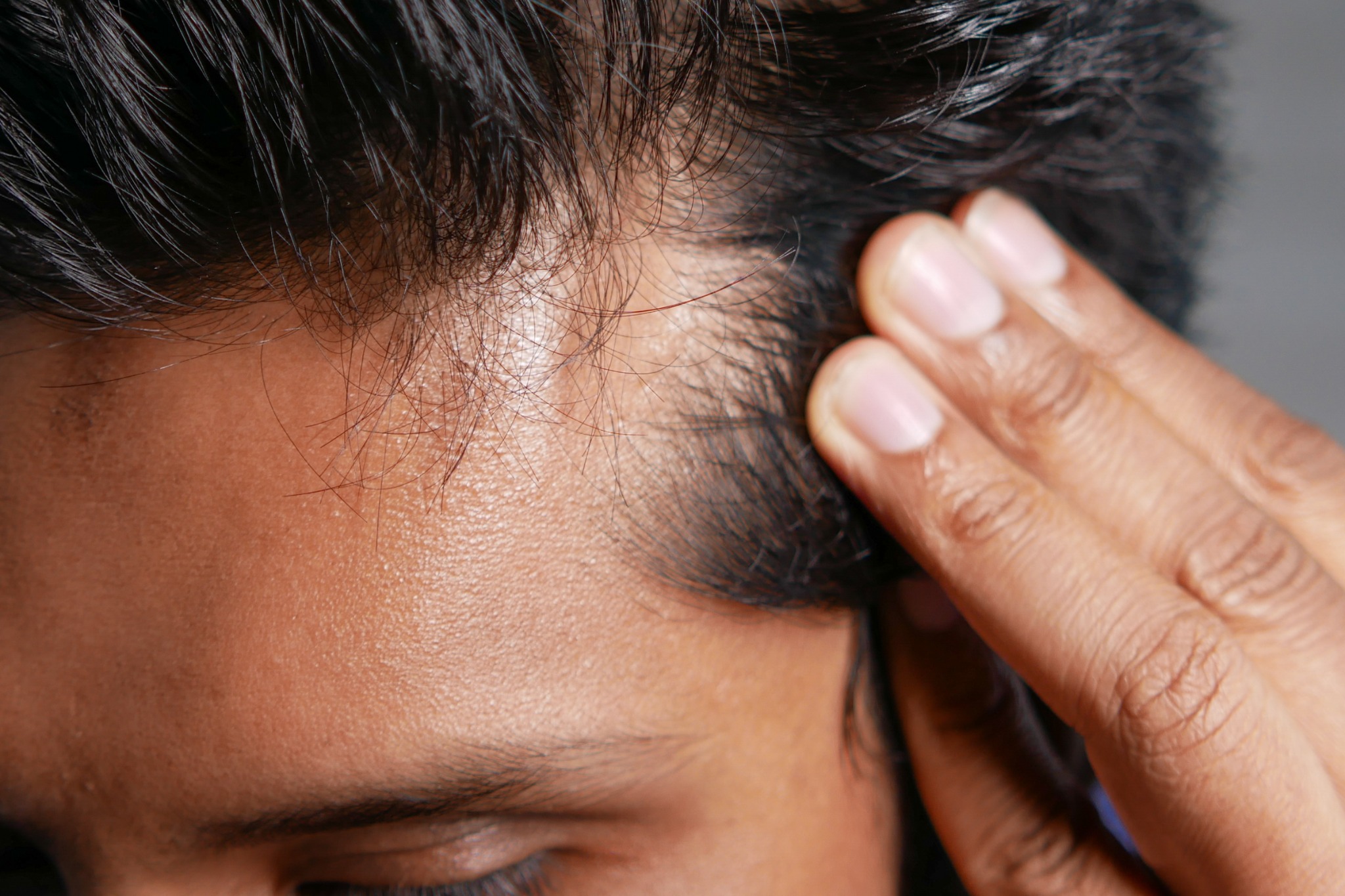 Chute cheveux : pourquoi on perd plus au printemps