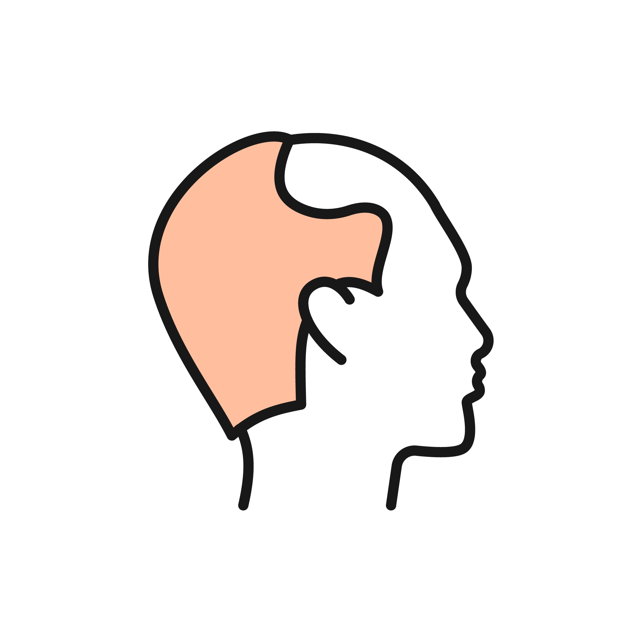 Comprendre l'alopécie féminine : Facteurs, diagnostic et solutions
