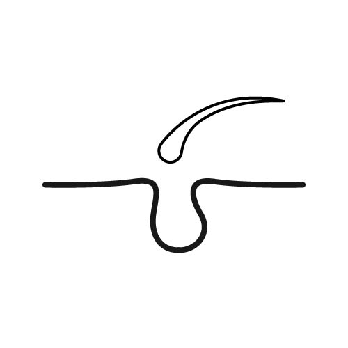 Teigne : quels sont les premiers symptômes et les traitements