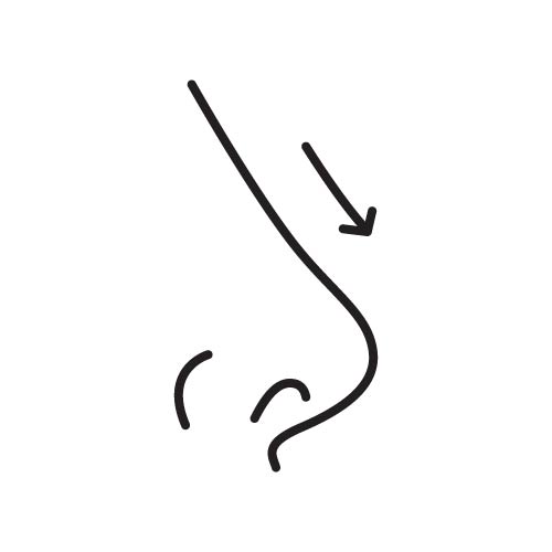 Traiter ses pommettes tombantes | soins sans chirurgie | Aesthé