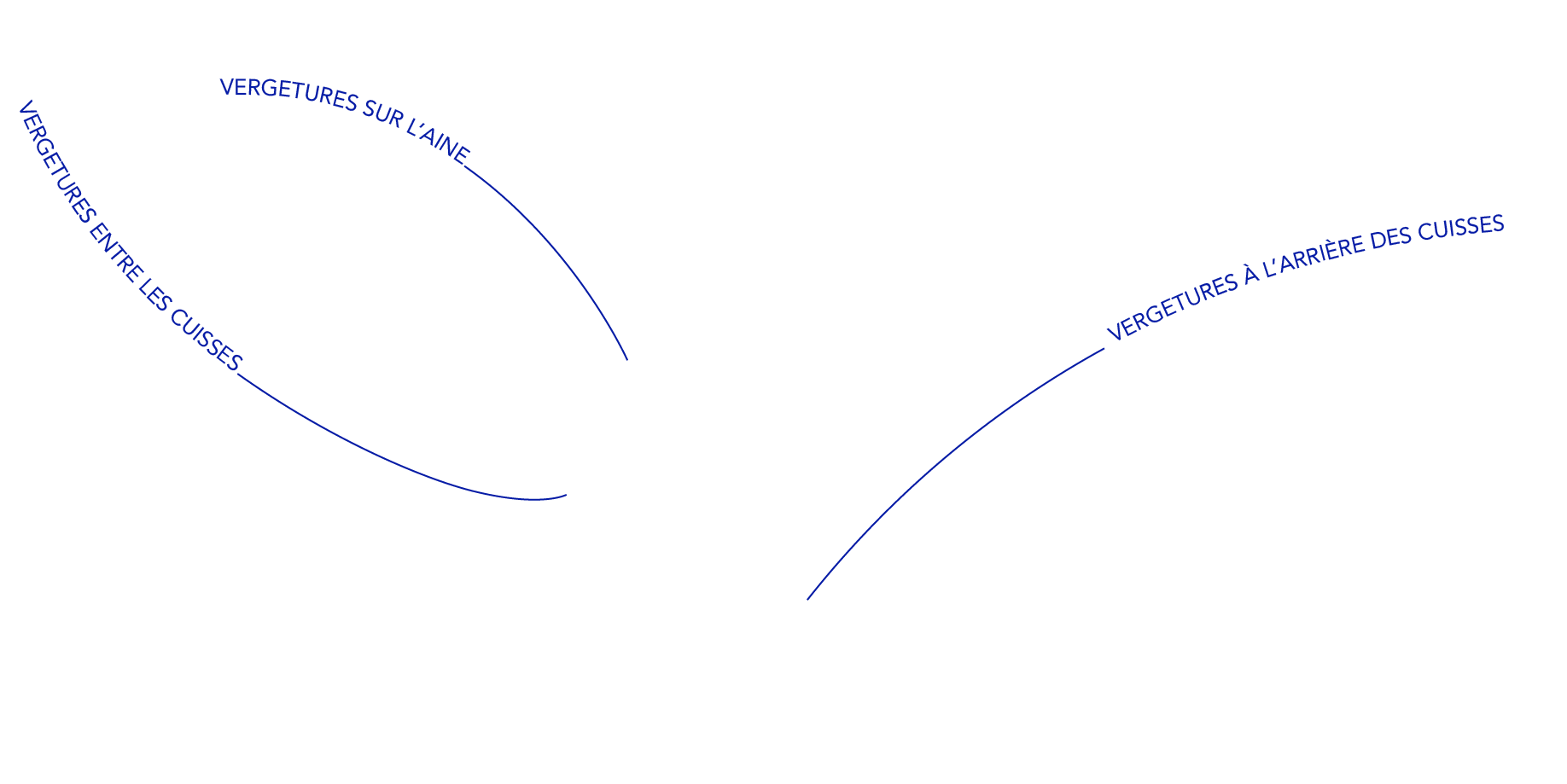 Dites adieu aux vergetures : Les meilleurs traitements