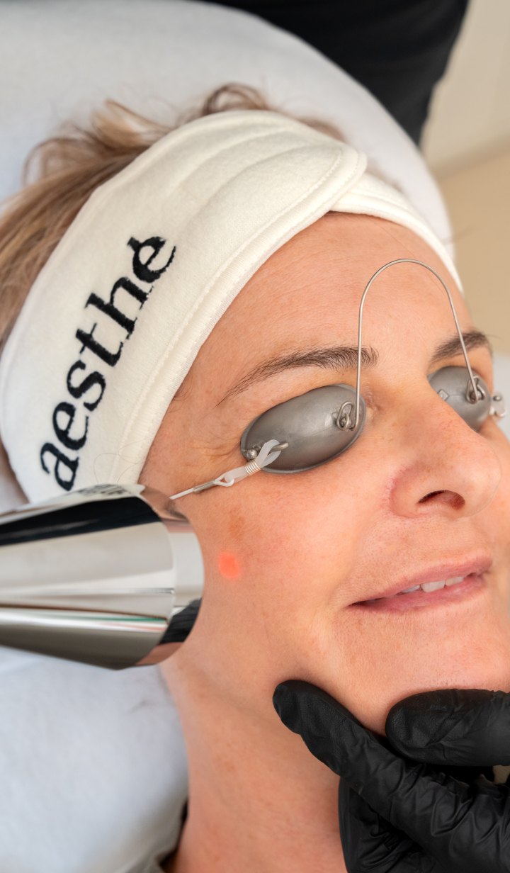 Laser Erbium : Rajeunissement avec précision et sécurité