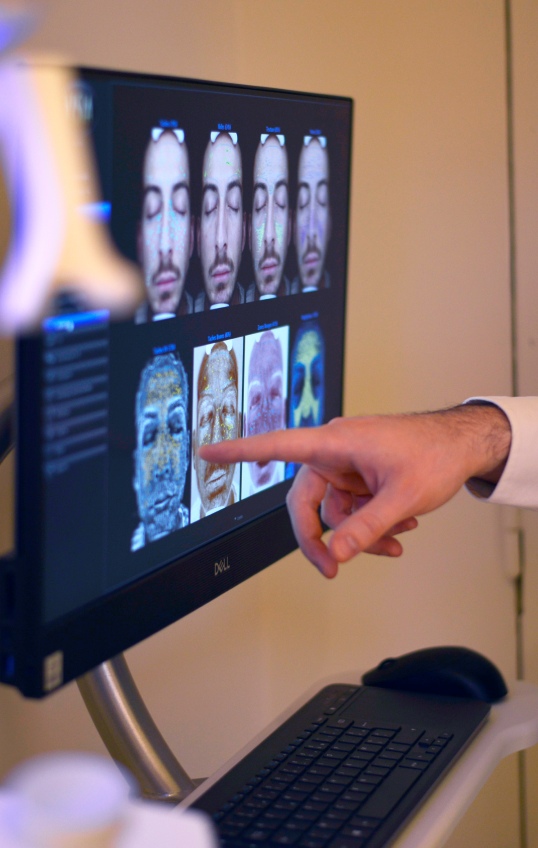 Analyse de peau avec Visia 7 : le bilan vieillissement de votre peau